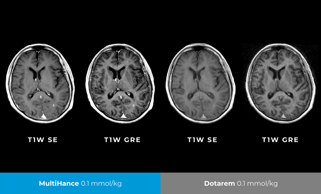 MultiHance - BraccoMR