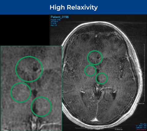AiMIFY™ - BraccoMR