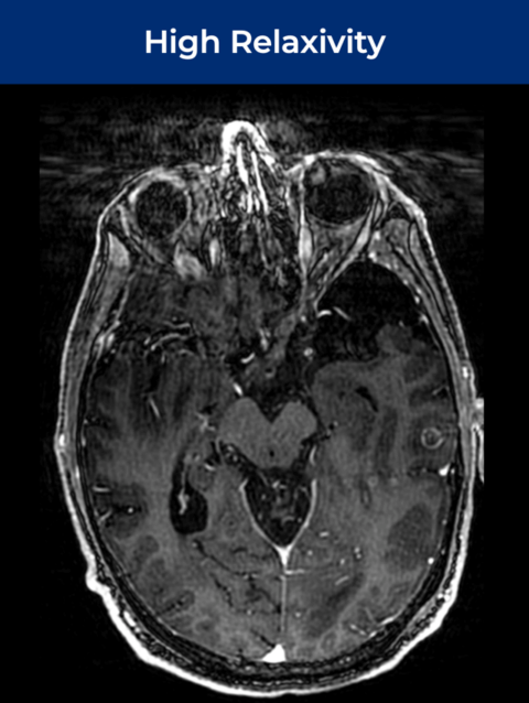 AiMIFY™ - BraccoMR