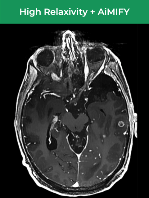 AiMIFY™ - BraccoMR